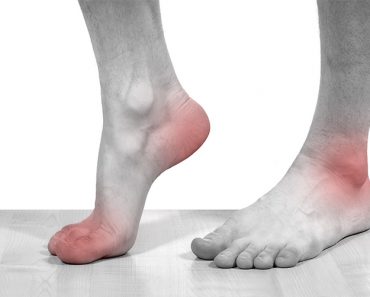 uric acid - Tips and Tricks
