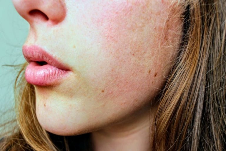 7 different types of 'stones' that can form in your body
