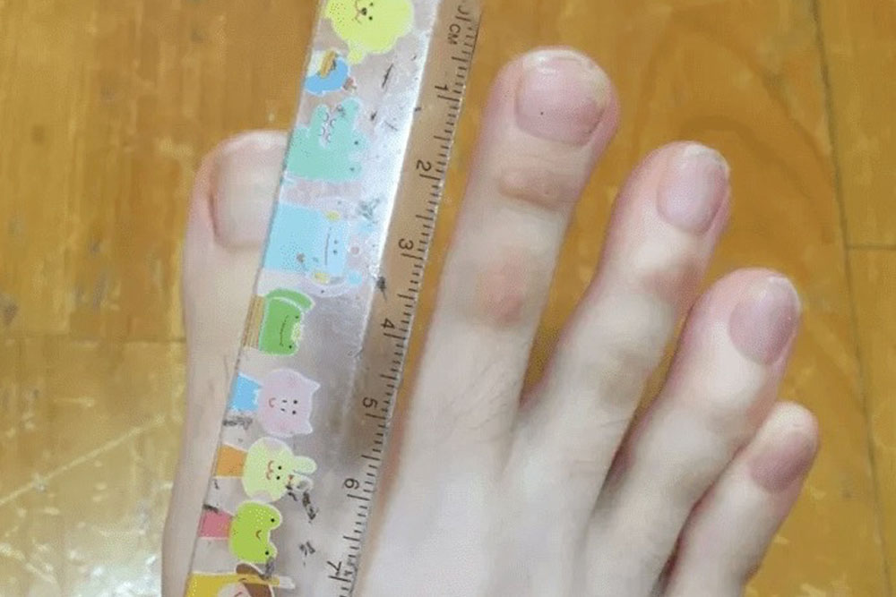 20 People With Unique Genetic Traits That Are Hard to Forget