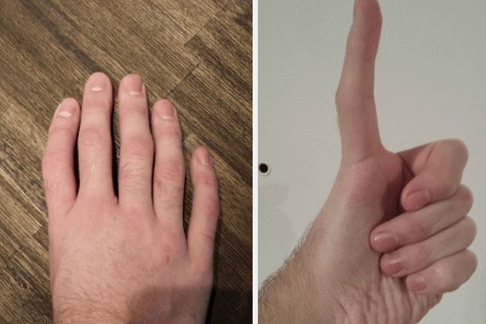 20 People With Unique Genetic Traits That Are Hard to Forget